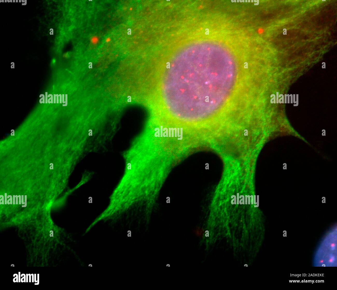 Astrocyte nerve cell. Fluorescent light micrograph of an astrocyte cell ...