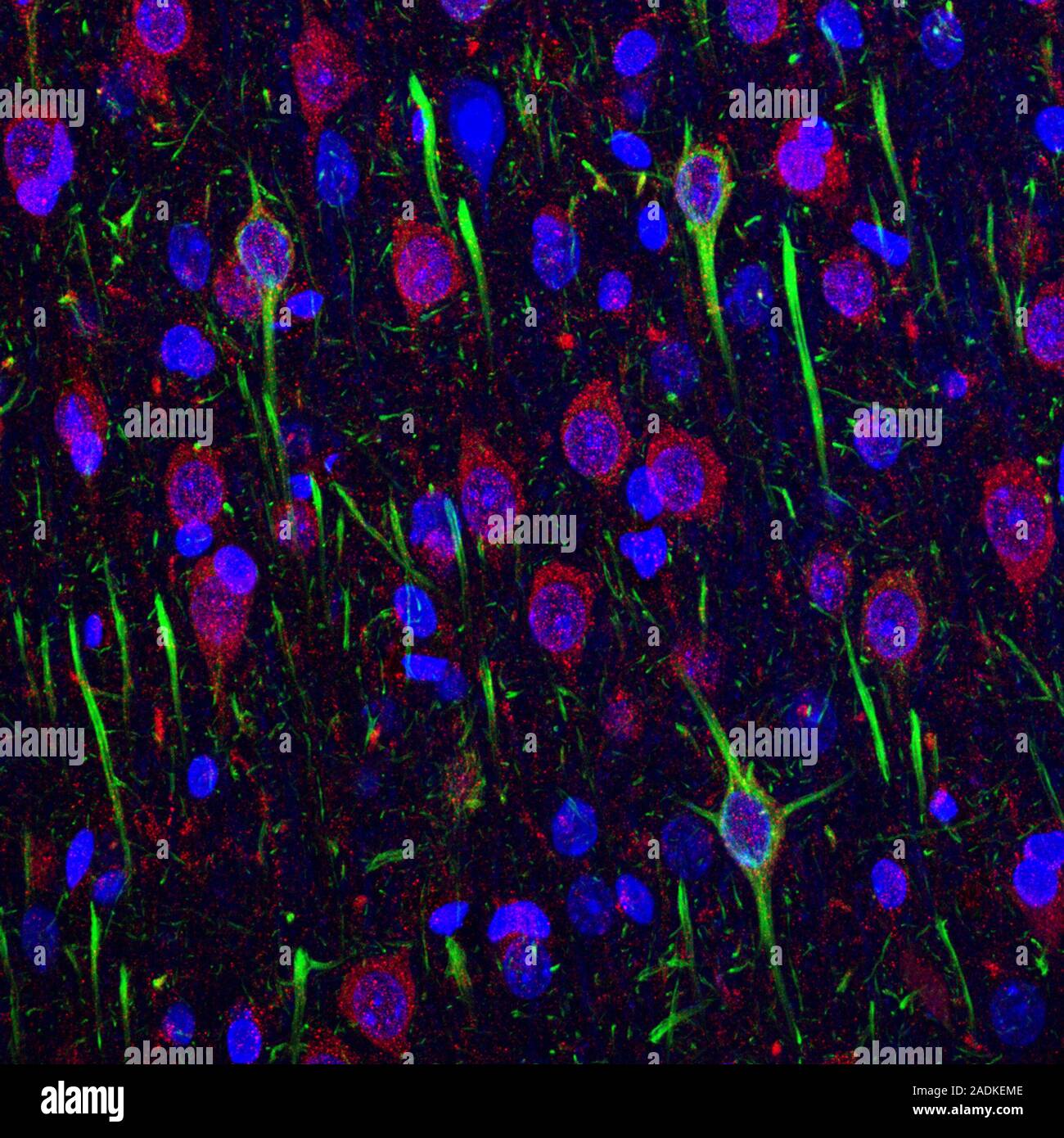 Cerebral cortex tissue. Confocal light micrograph of a section through ...