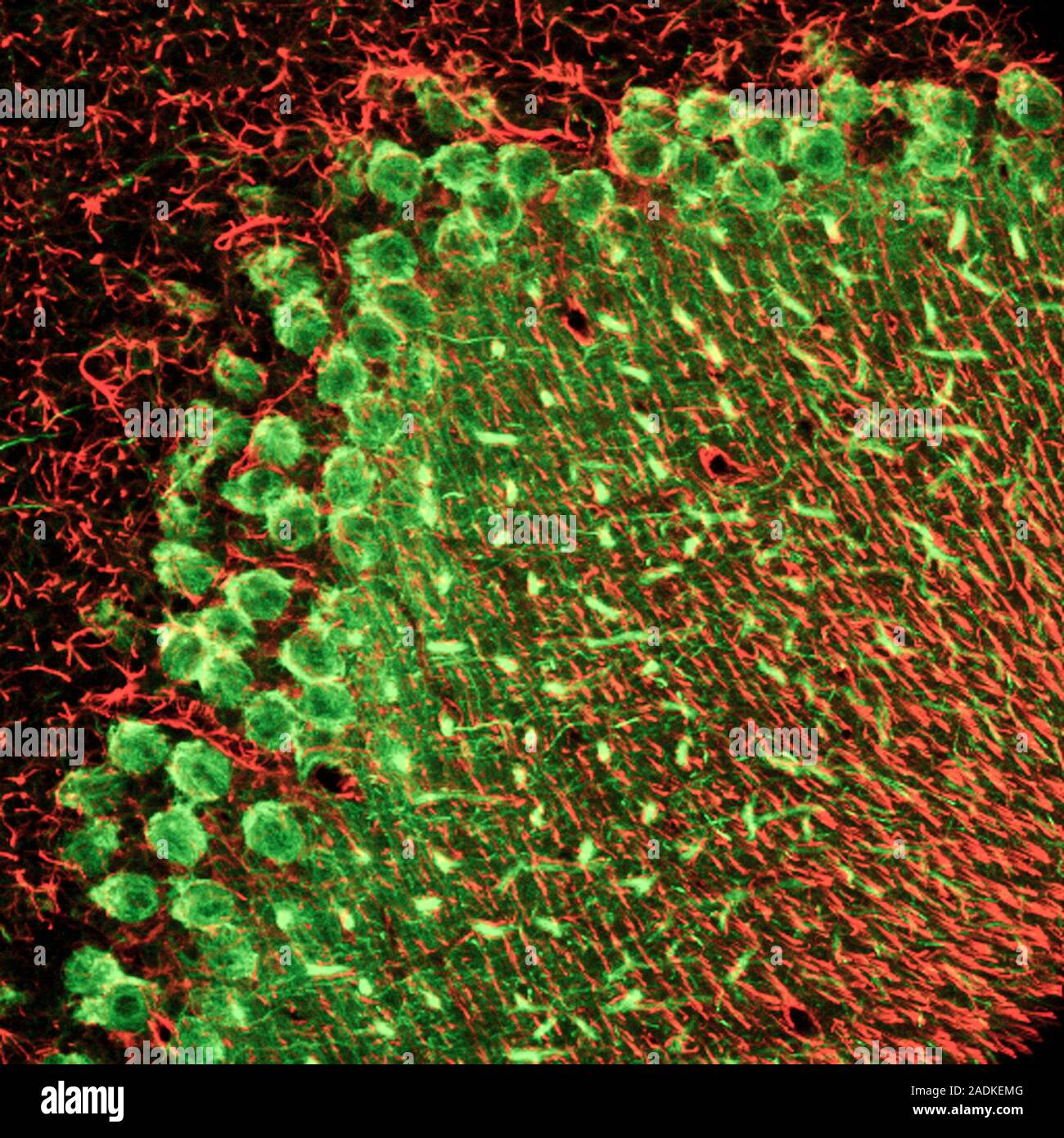 Cerebellum nerve cells. Confocal light micrograph of granule neurons ...