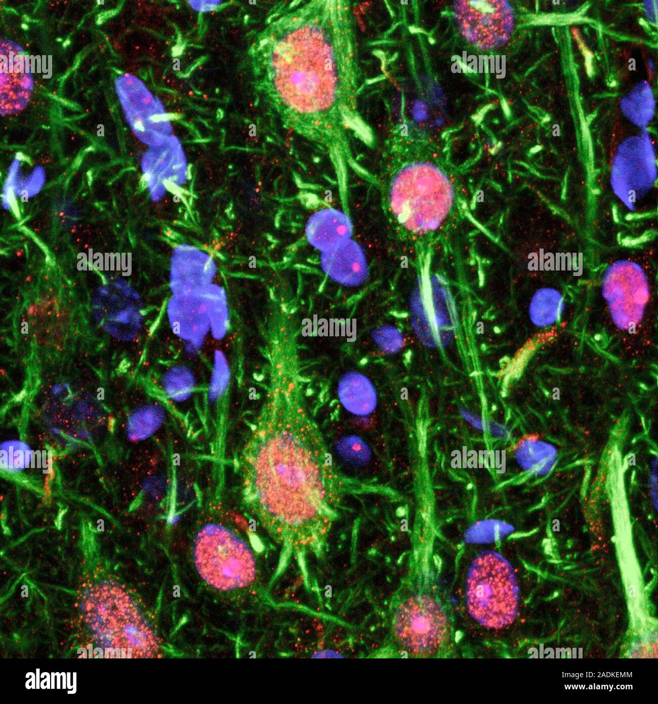 Hormone receptor nerve cells. Confocal light micrograph of orexin ...