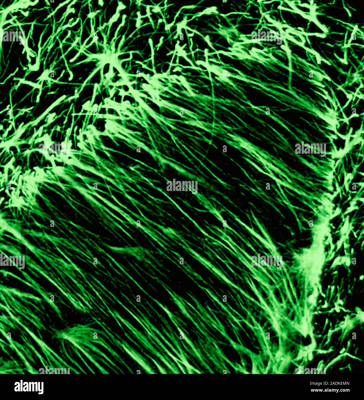 Cerebellum tissue. Confocal light micrograph of a section through the ...