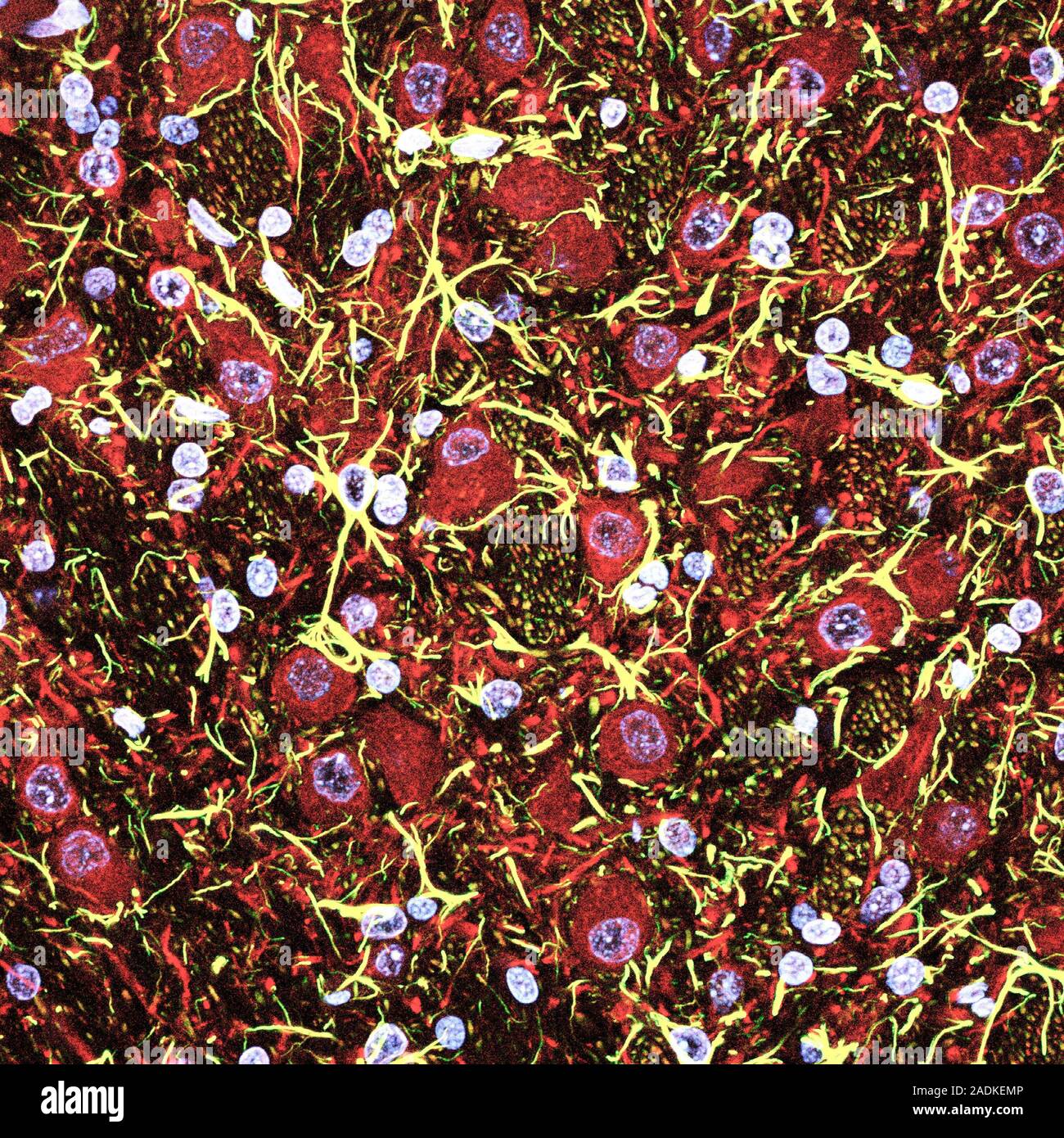 Cerebral cortex nerve cells. Confocal light micrograph of neurons ...