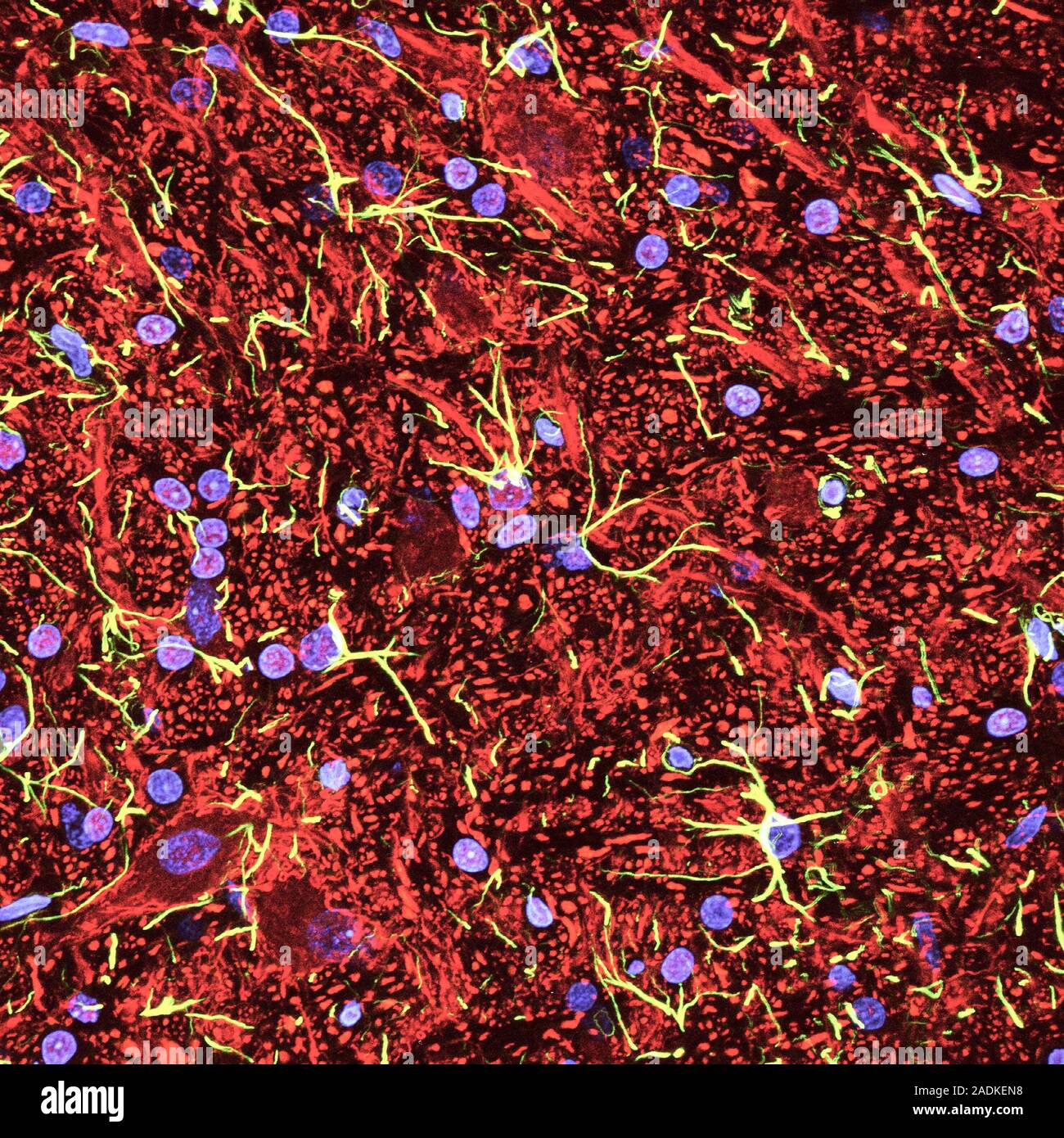Brainstem nerve cells. Confocal light micrograph of neurons (nerve ...