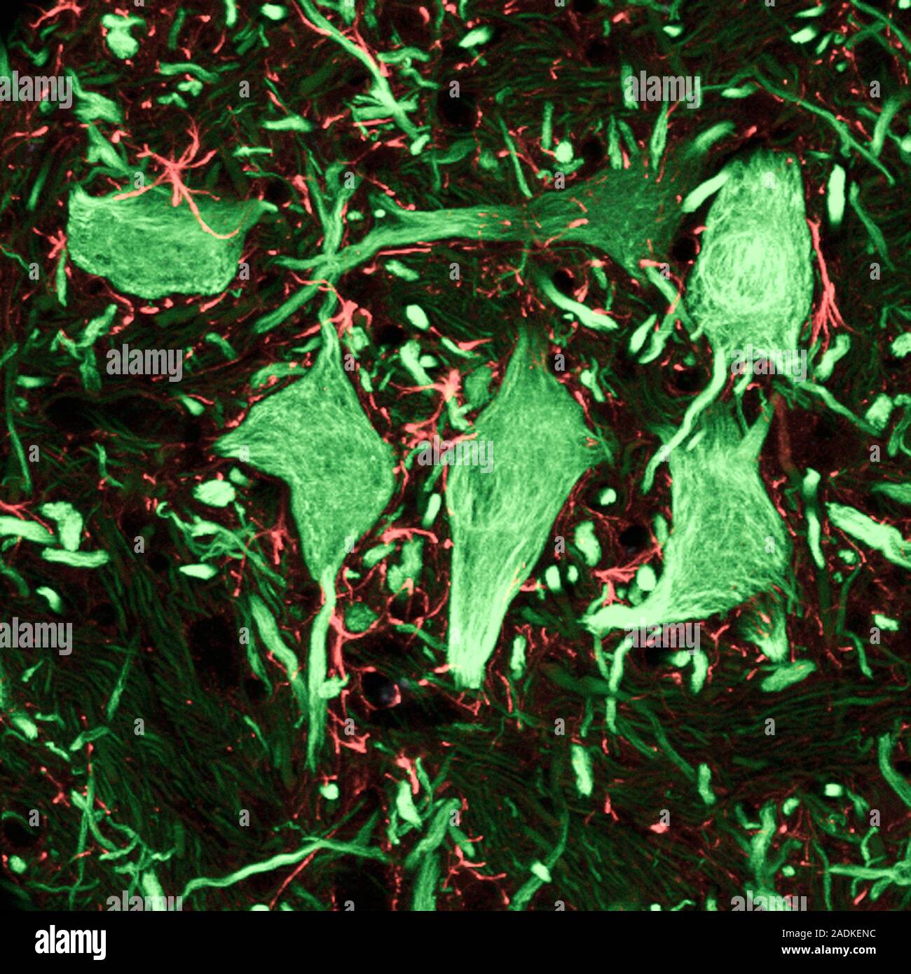 Neurons. Confocal light micrograph of neurons (nerve cells, green) from ...