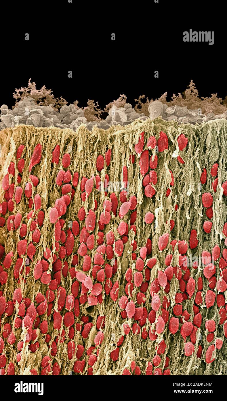 Foetal brain cells. Coloured scanning electron micrograph (SEM) of ...