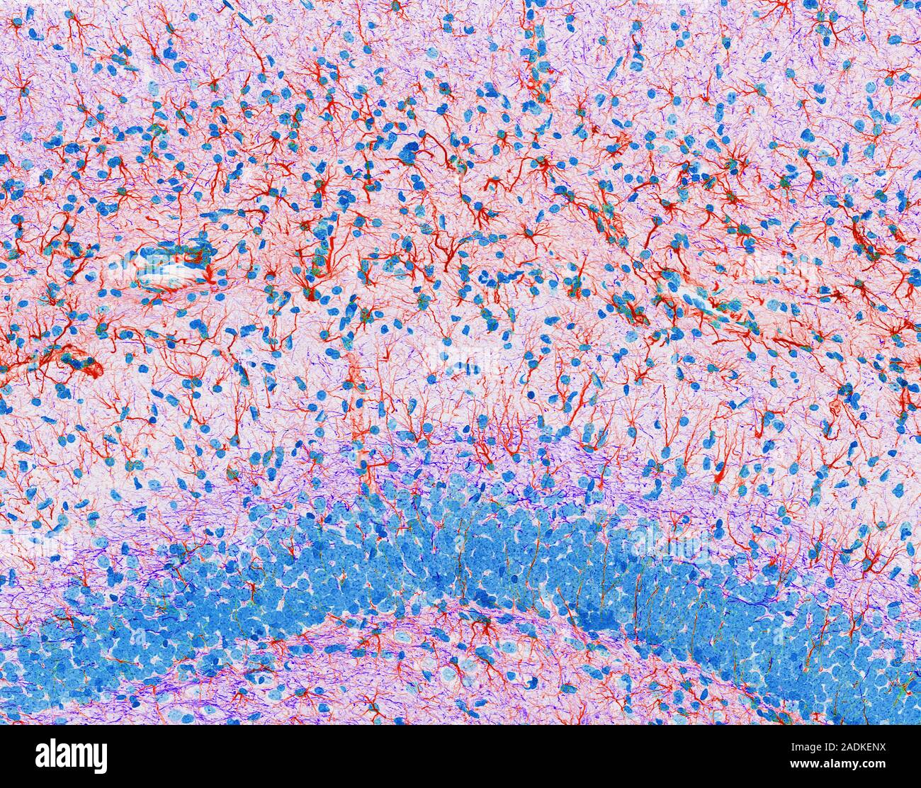 Hippocampus tissue. Light micrograph of a sagittal (side view) section ...
