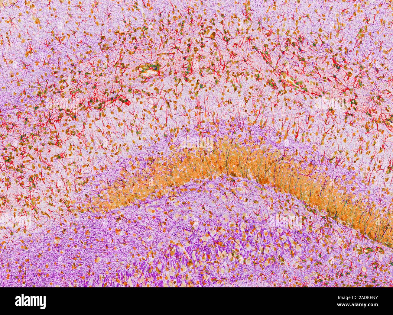 Hippocampus tissue. Light micrograph of a sagittal (side view) section ...