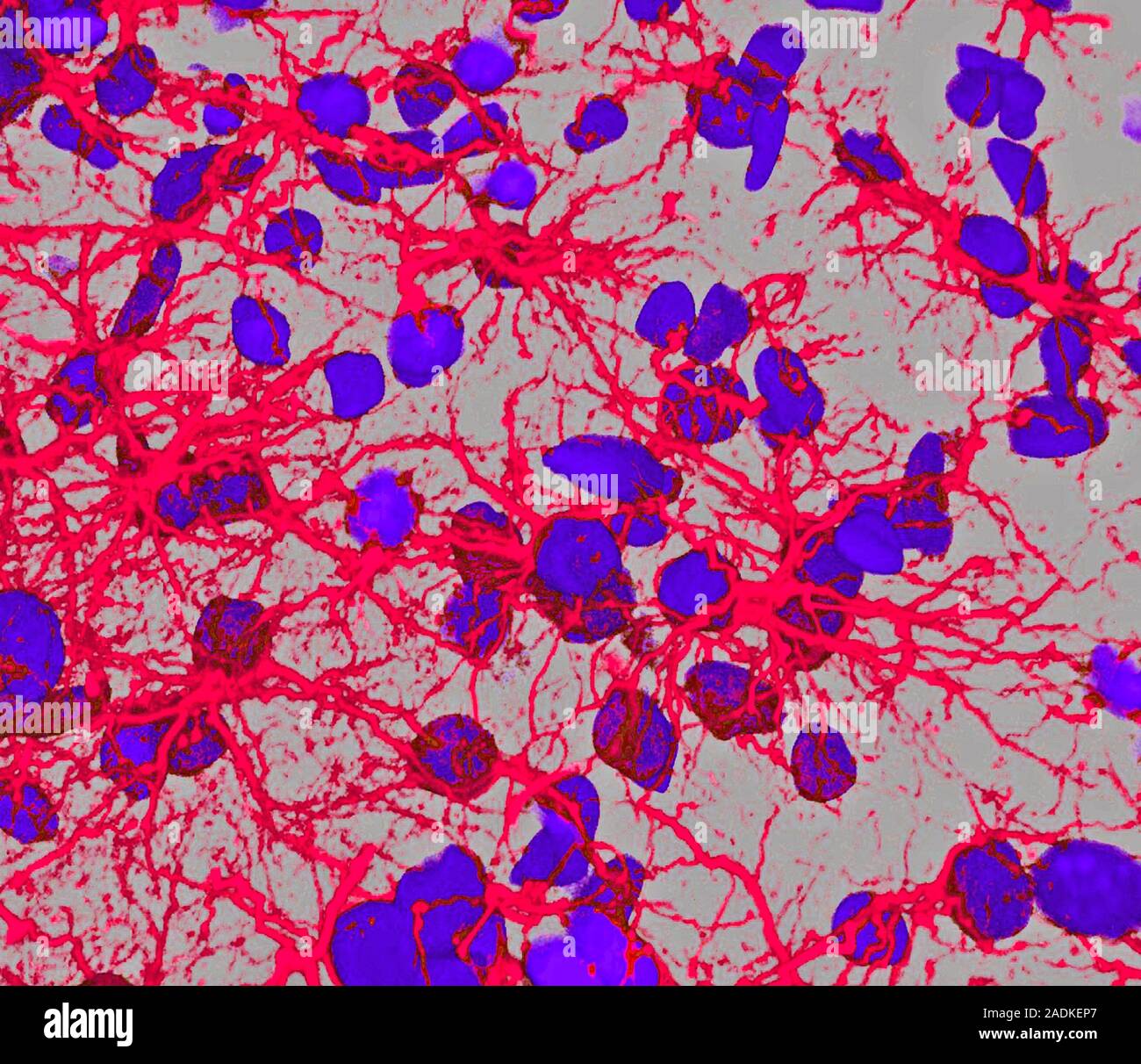 Glial cells. Fluorescent light micrograph of glial cells from a mouse ...