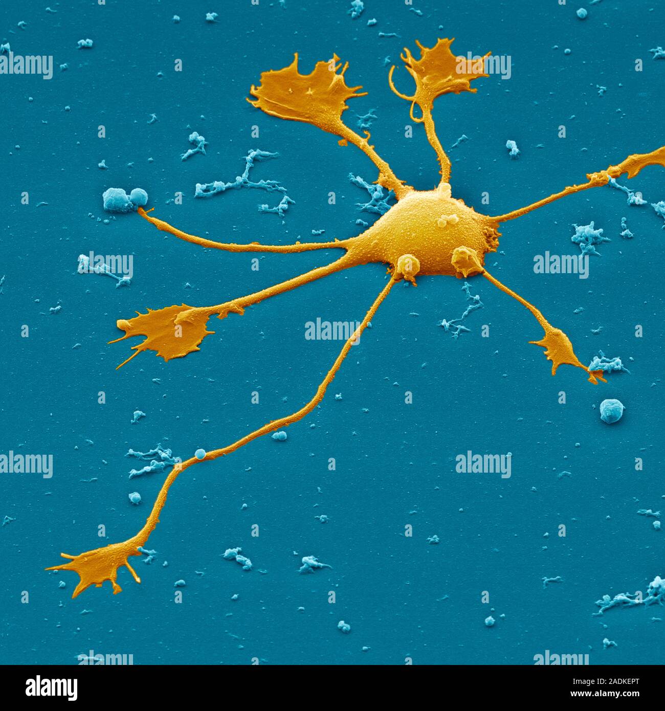 Nerve cell. Coloured scanning electron micrograph (SEM) of a nerve cell ...