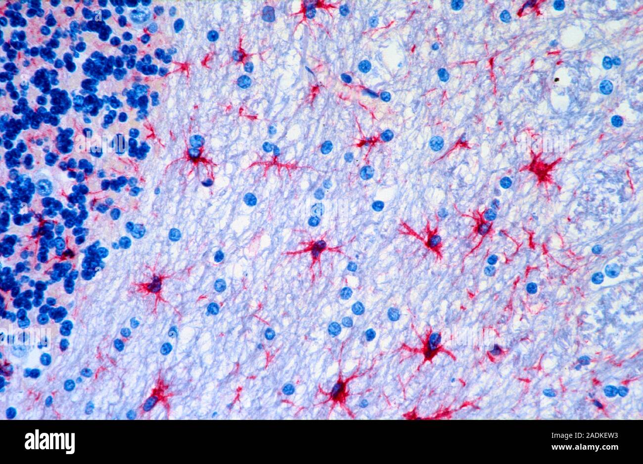 Astrocyte brain cells. Light micrograph of a longitudinal section ...