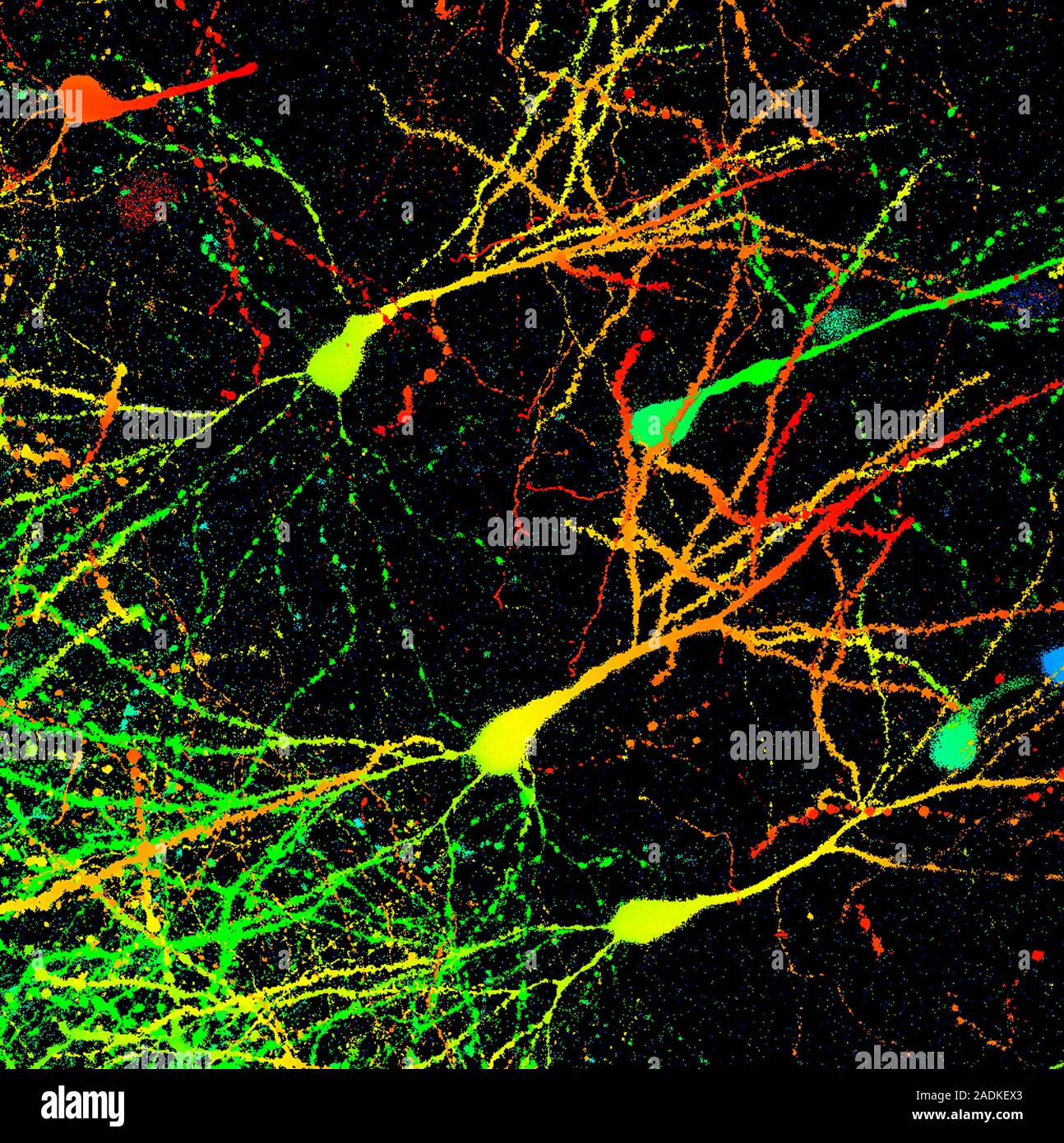 Mouse brain neurons. Light micrograph (LM) showing brain neurons ...