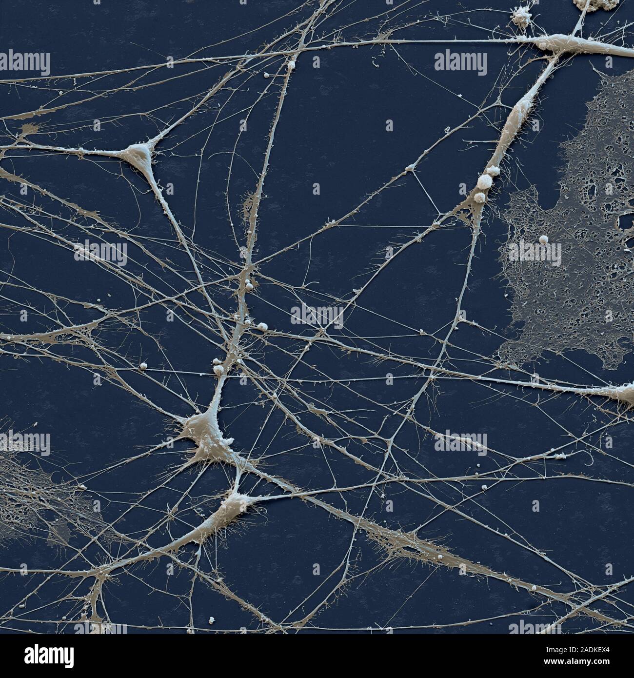 Spinal ganglion nerve cells, coloured scanning electron micrograph (SEM ...