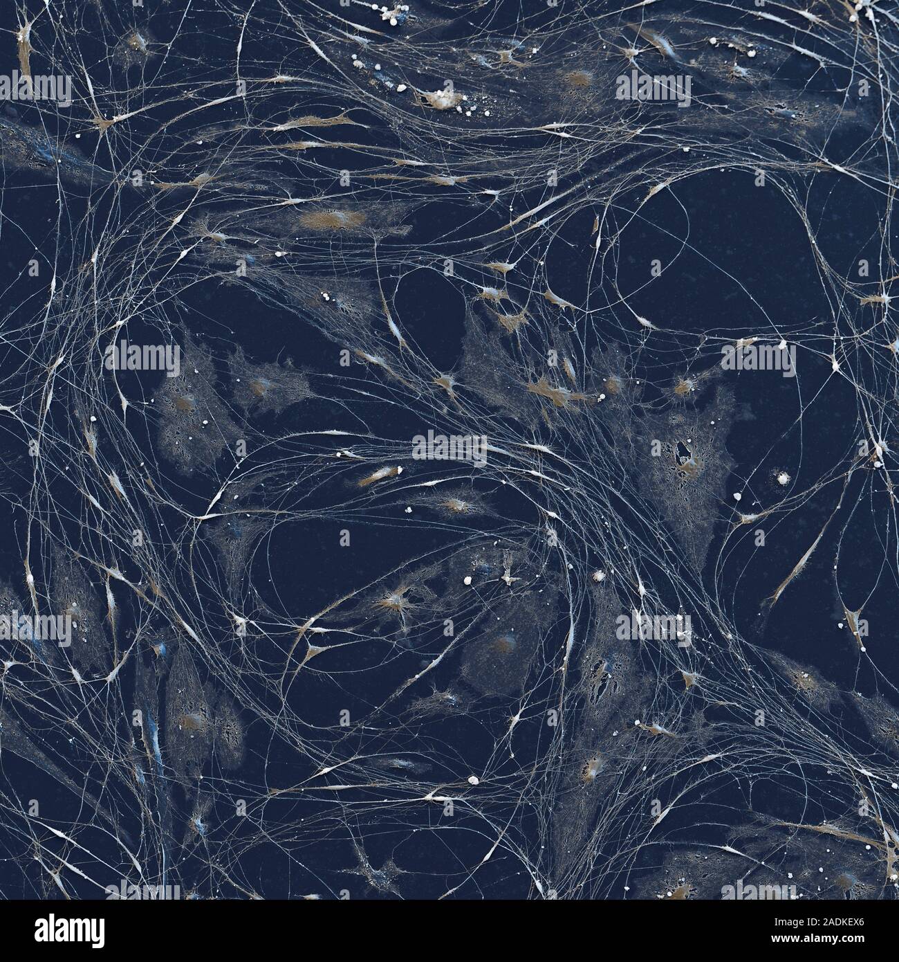 Spinal ganglion nerve cells, coloured scanning electron micrograph (SEM ...