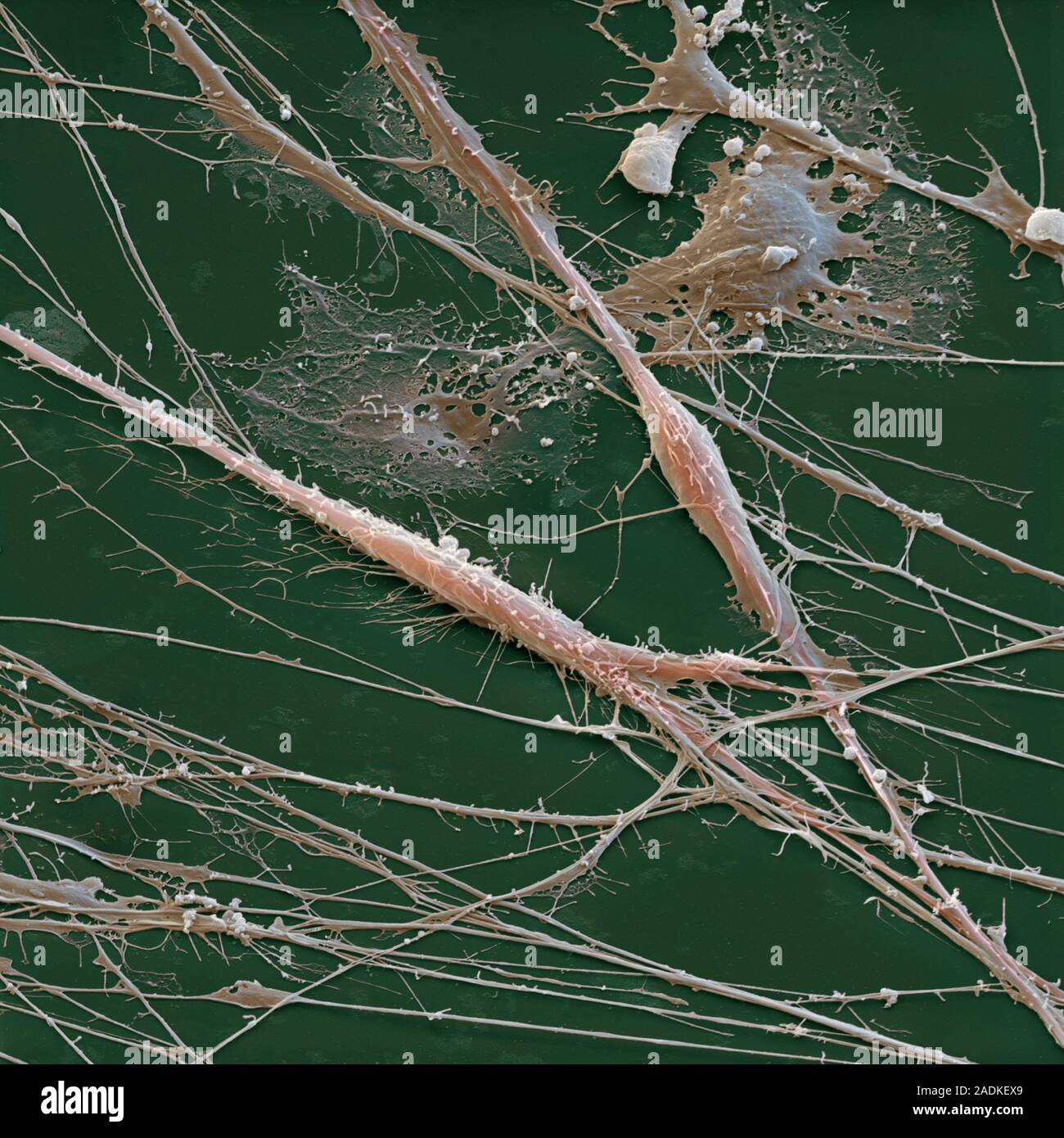 Spinal ganglion nerve fibres, coloured scanning electron micrograph ...