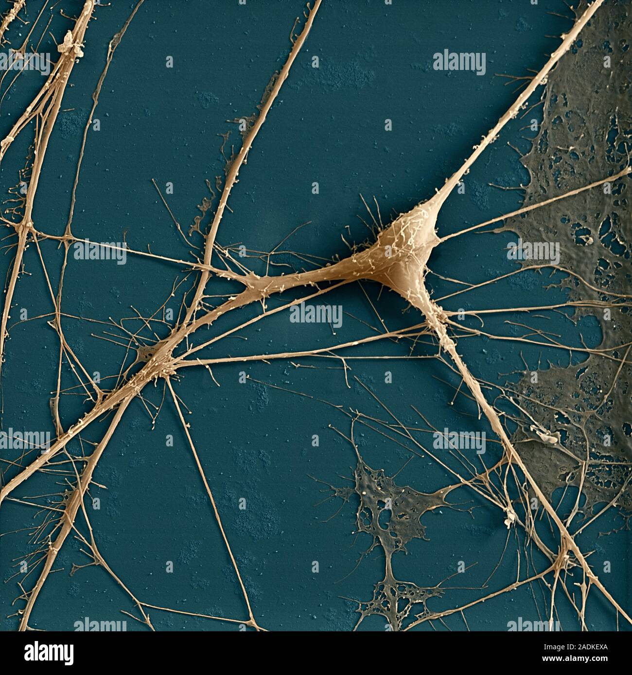 Spinal ganglion nerve cells, coloured scanning electron micrograph (SEM ...
