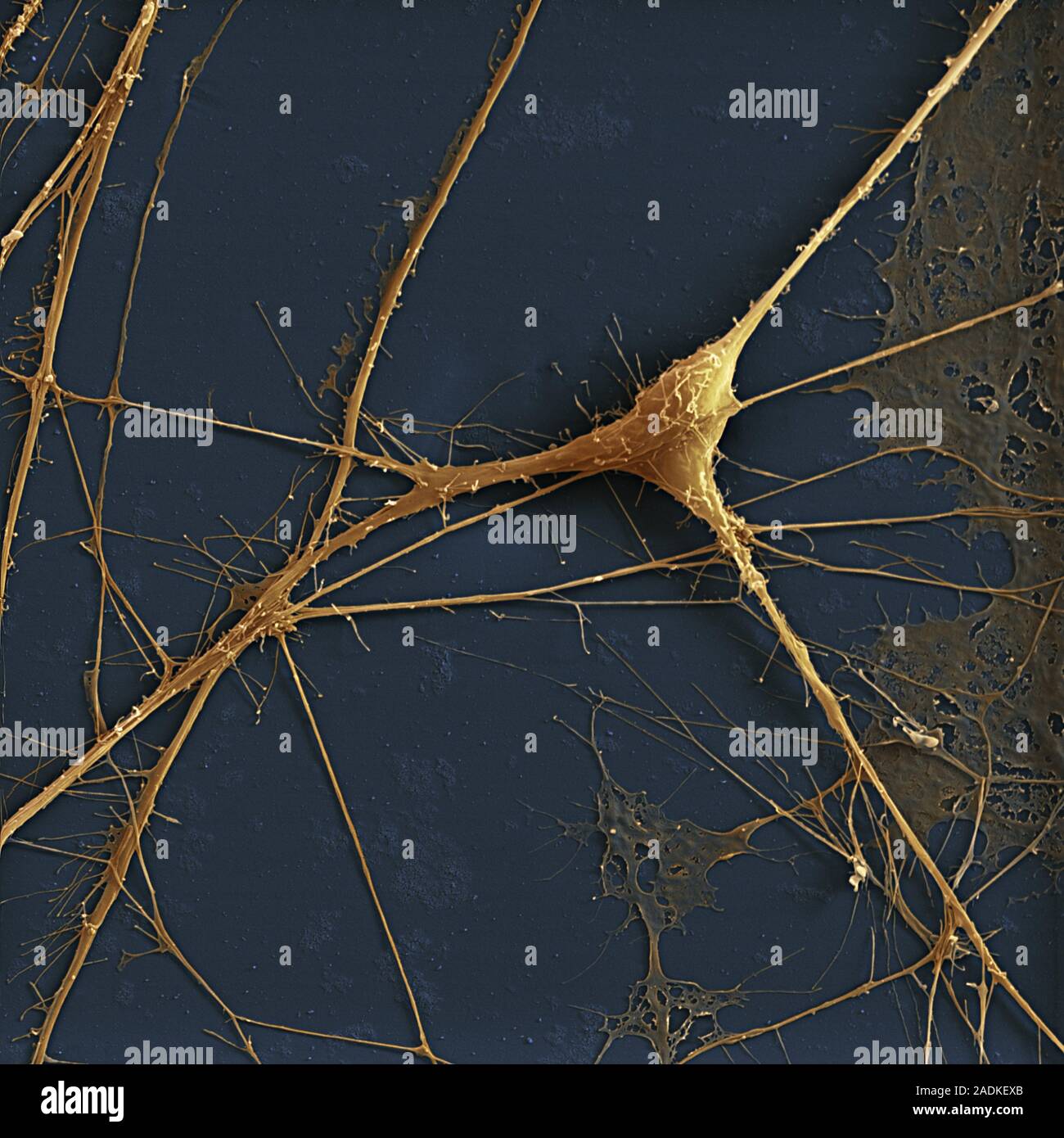 Spinal ganglion nerve cells, coloured scanning electron micrograph (SEM ...
