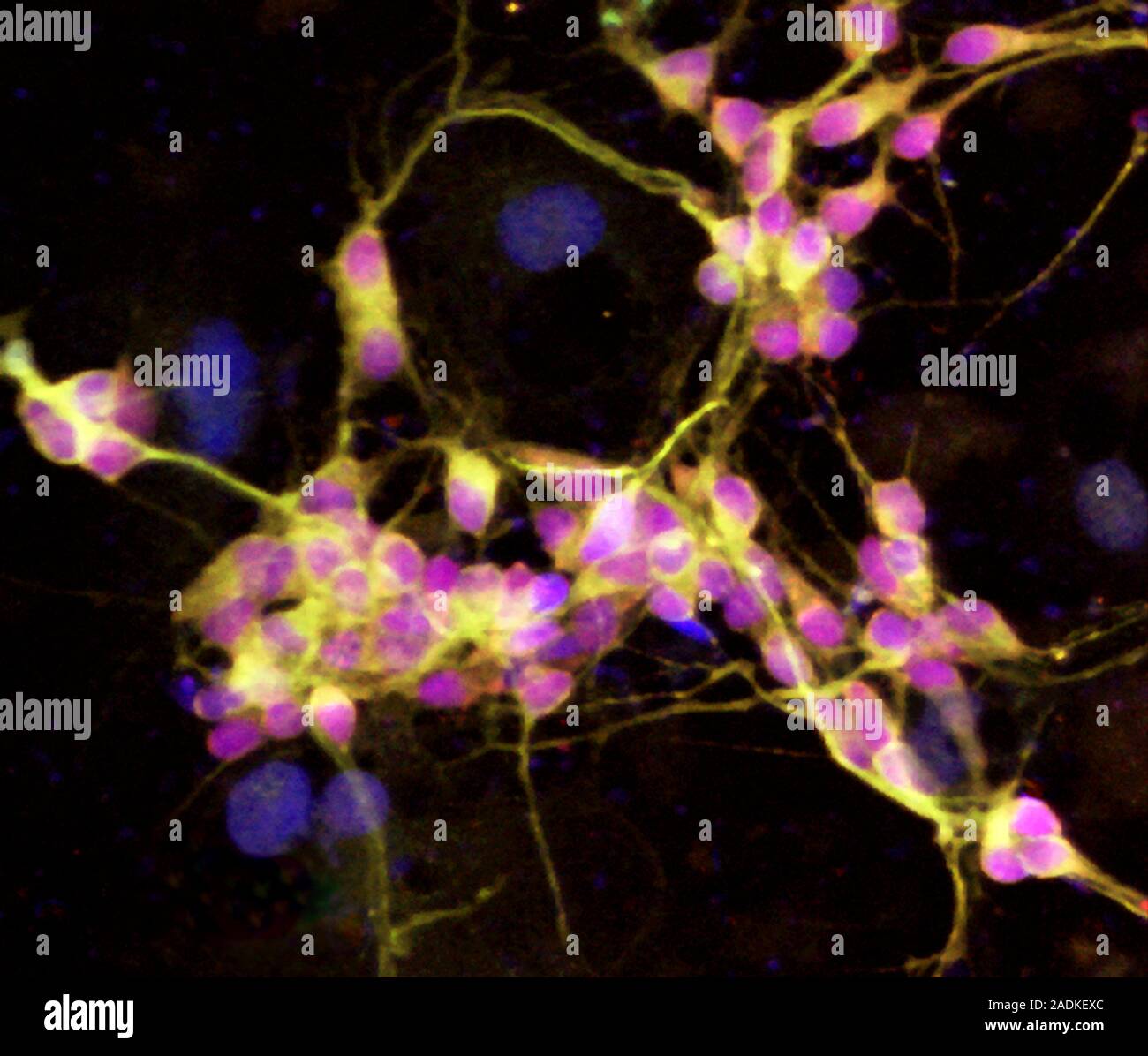 Nerve cell growth. Laser scanning micrograph of nerve cells (neurons ...