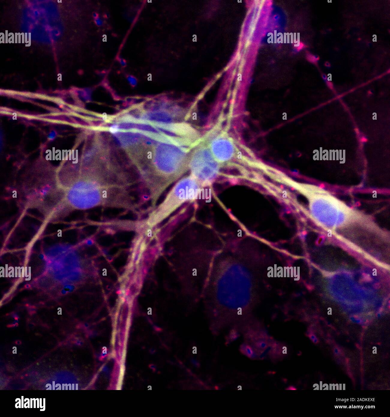 Nerve cell growth. Laser scanning micrograph of nerve cells (neurons ...