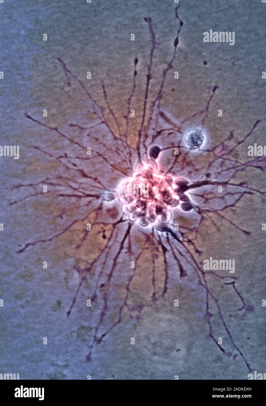Nerve cell growth. Coloured light micrograph of a 1-week old, nerve ...