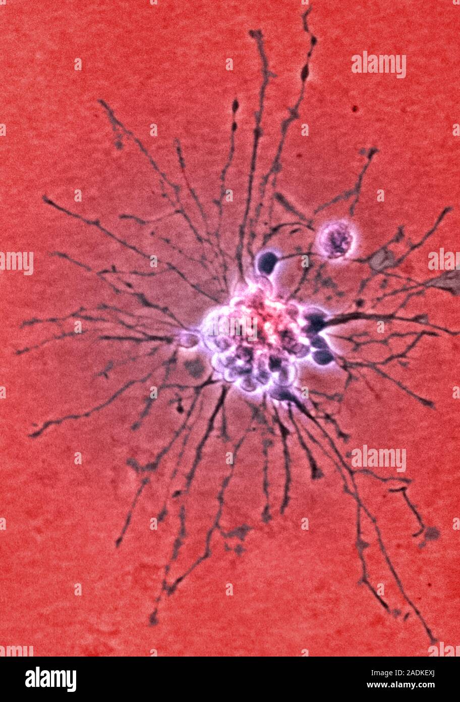 Nerve cell growth. Coloured light micrograph of a 1-week old, nerve ...