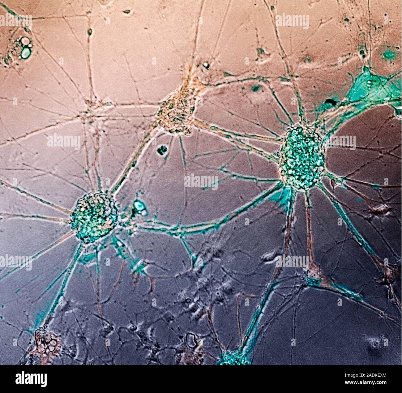 Nerve cell growth. Coloured light micrograph of 3-week old, nerve cell ...