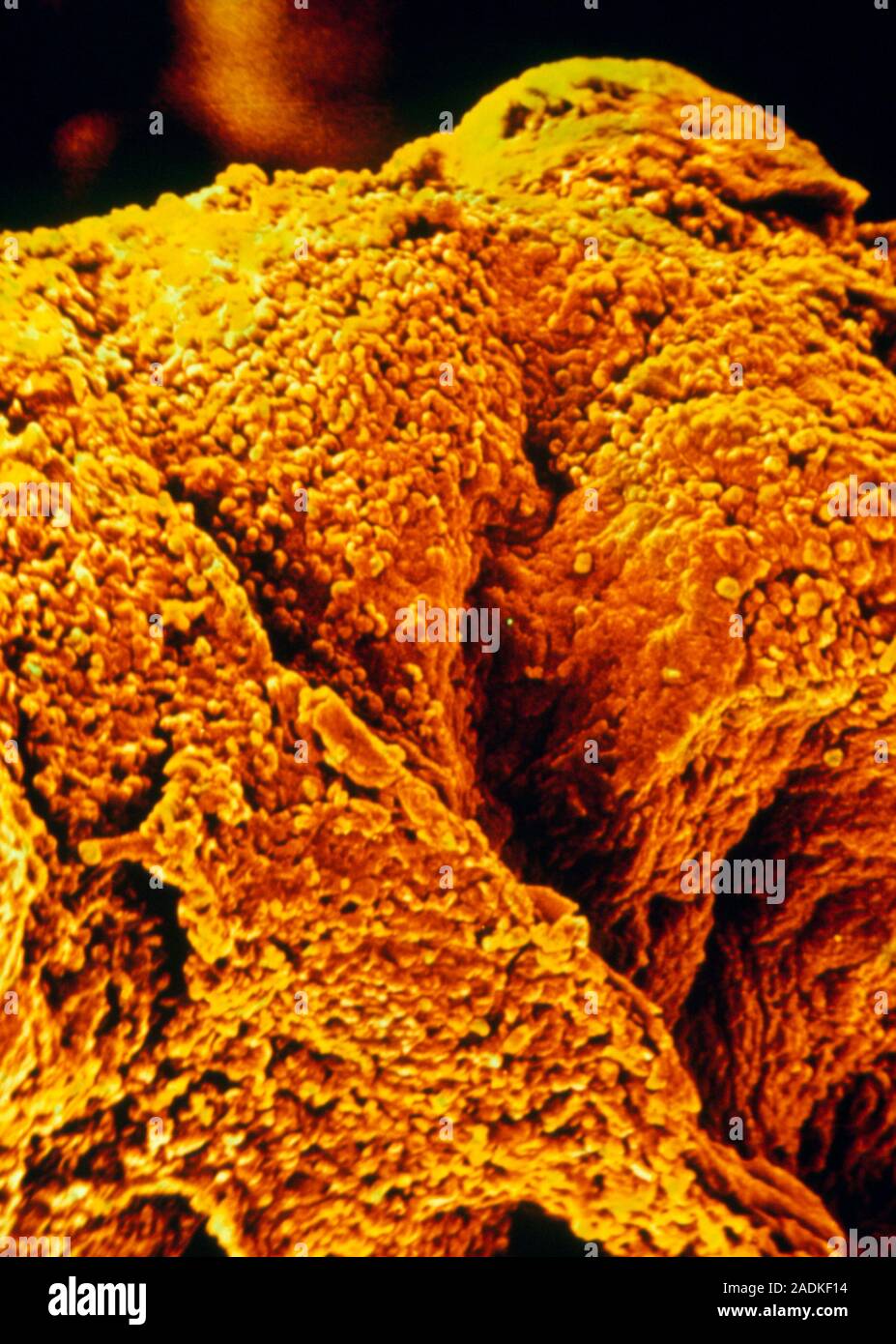 Scanning electron micrograph (SEM) of a section of the mucous-secreting ...