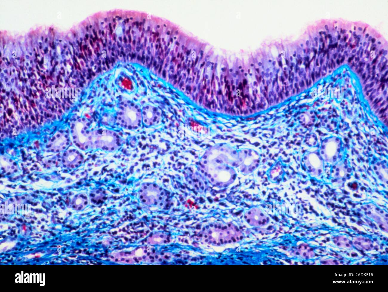 Light micrograph of human nasal mucosa, found lining the airways of the ...