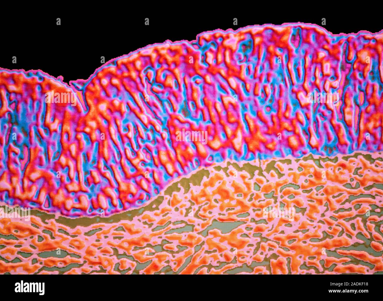 Nasal mucous membrane. Computer-enhanced light micrograph of a section ...