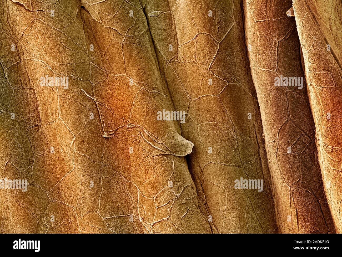 Nasal lining. Coloured scanning electron micrograph (SEM) of folded ...