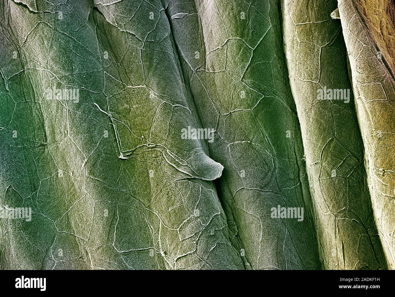 Nasal lining. Coloured scanning electron micrograph (SEM) of folded ...