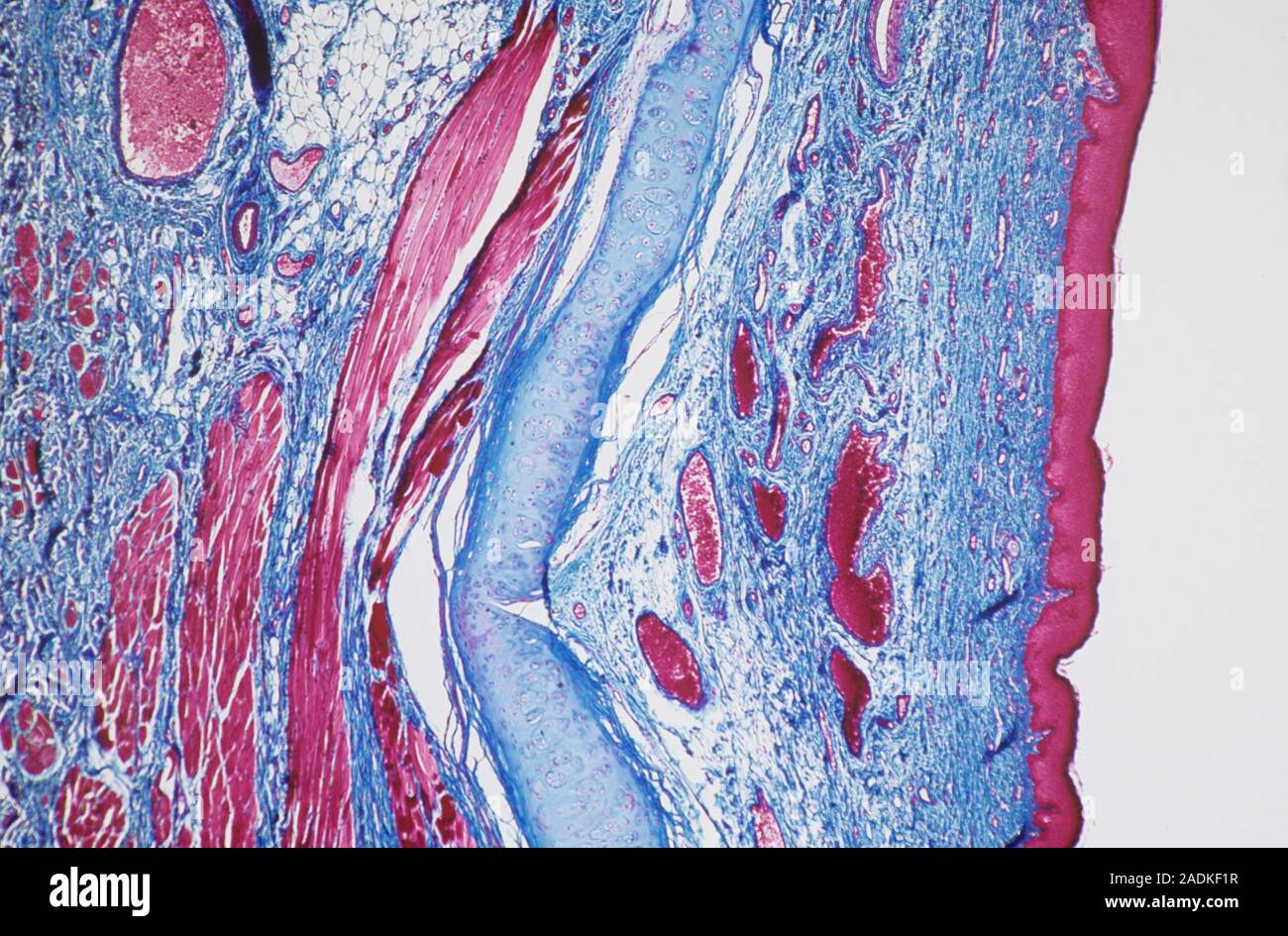 Nose mucosa. Light micrograph of a section through the nasal mucosa ...