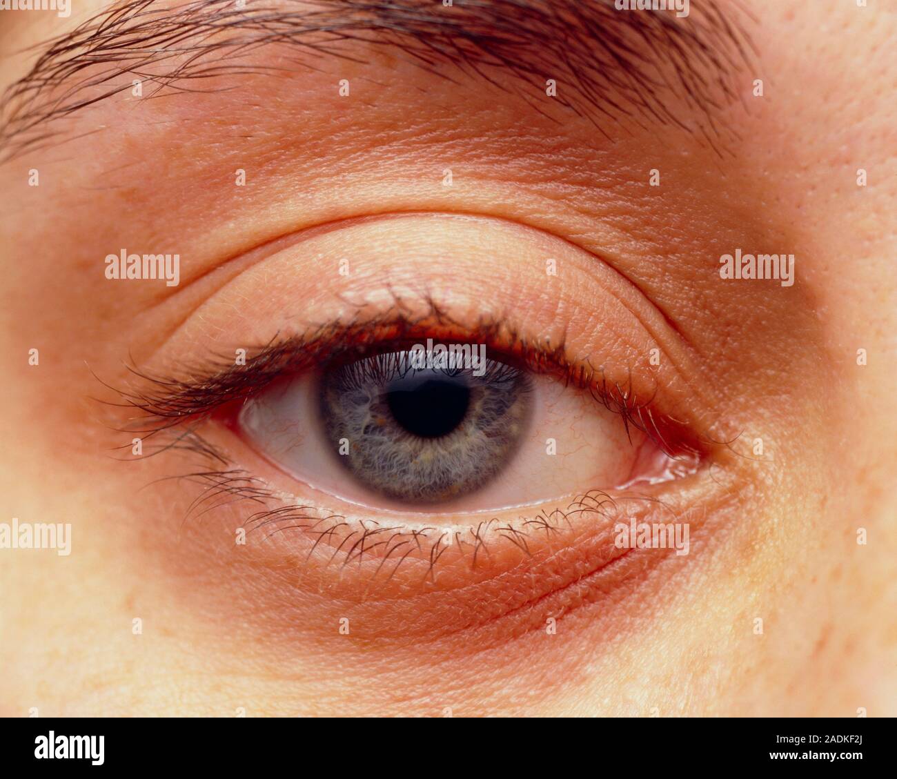 Close-up of a healthy female eye (26 years old) showing normal pupil ...