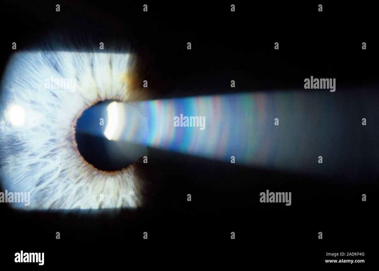 Vision. Macrophotograph of a human eye, showing a rainbow of light ...
