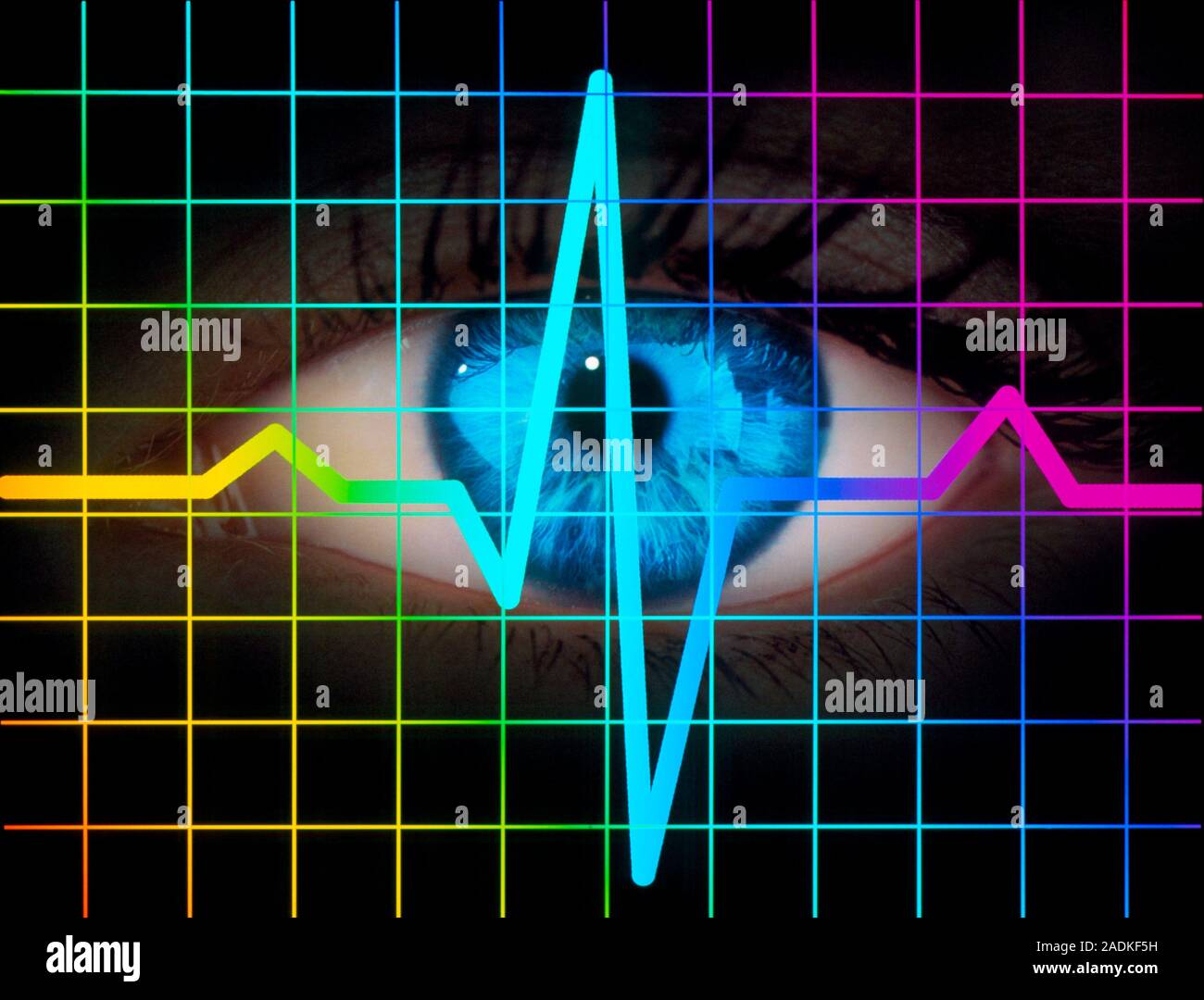 Vision. Computer artwork showing a normal human heart trace or ...
