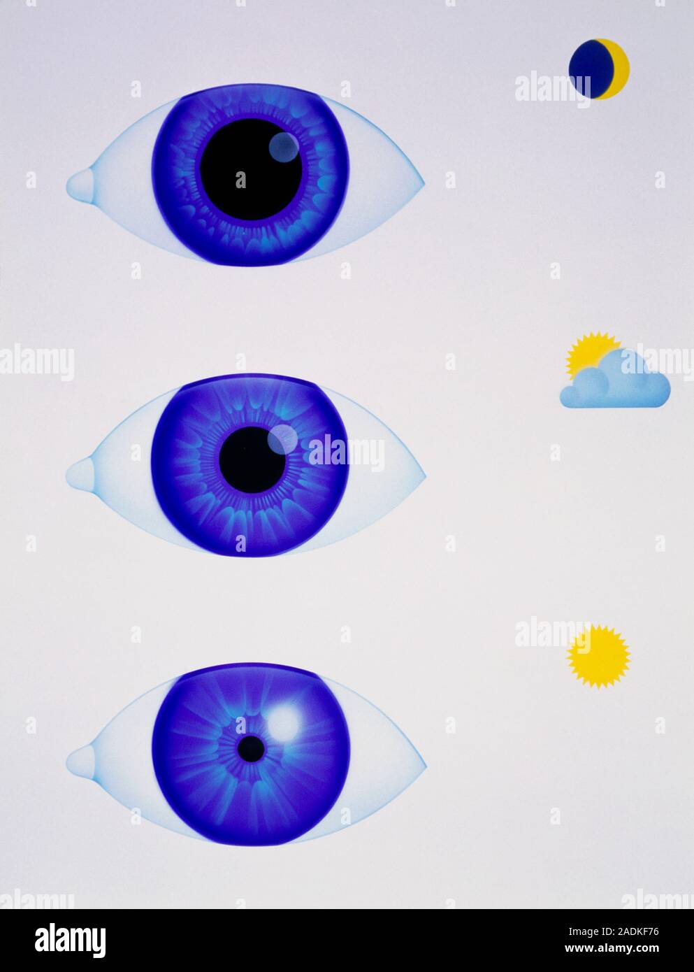 Pupil of eye. Artwork showing how the pupil of the eye reacts in three ...