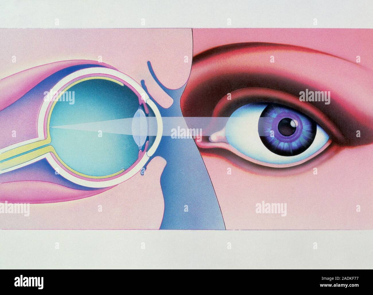 Human eye. Artwork of a human eye in front view and in section. At ...