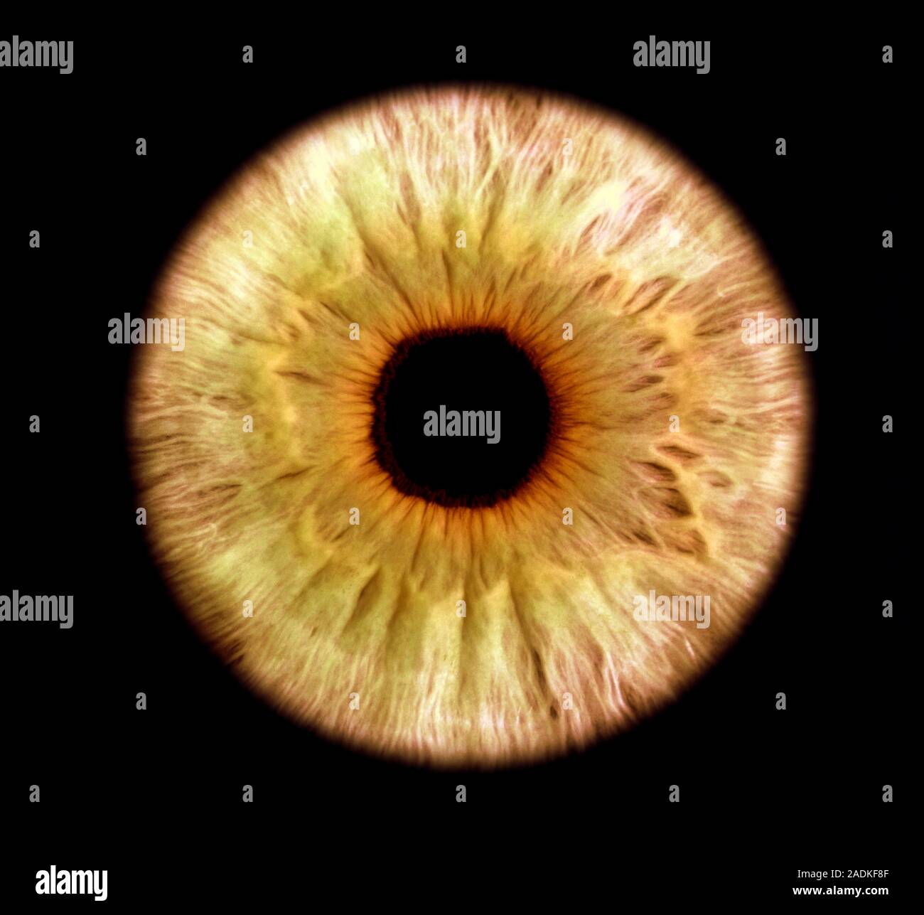 Iris. Computer-enhanced image of the green iris of a human eye. The ...