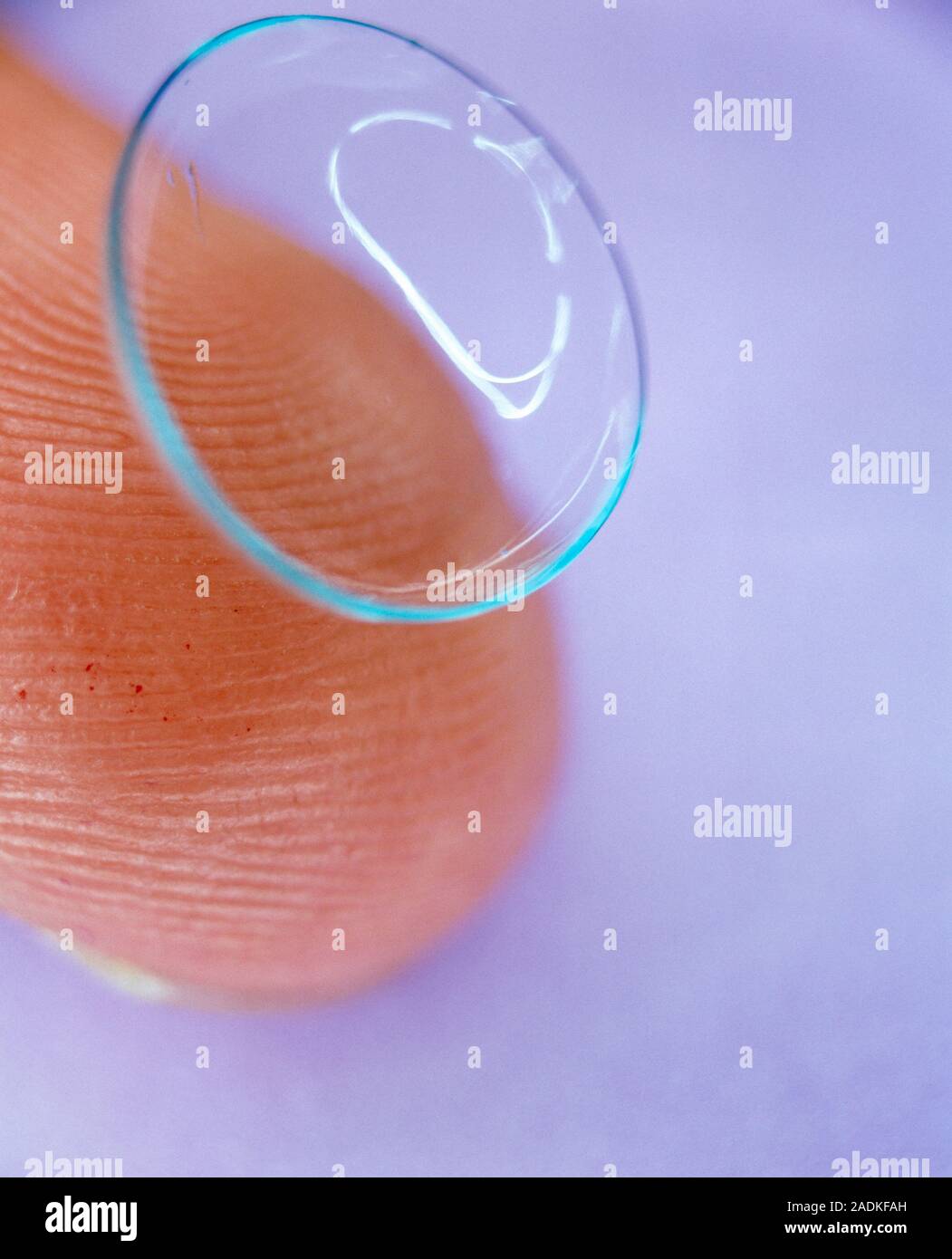 Contact lens. This is a thin plastic lens worn on the surface of the ...