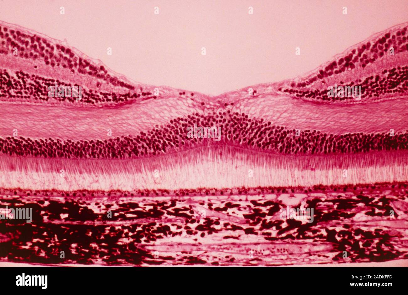 Light micrograph through a section of the human eye in the region of ...