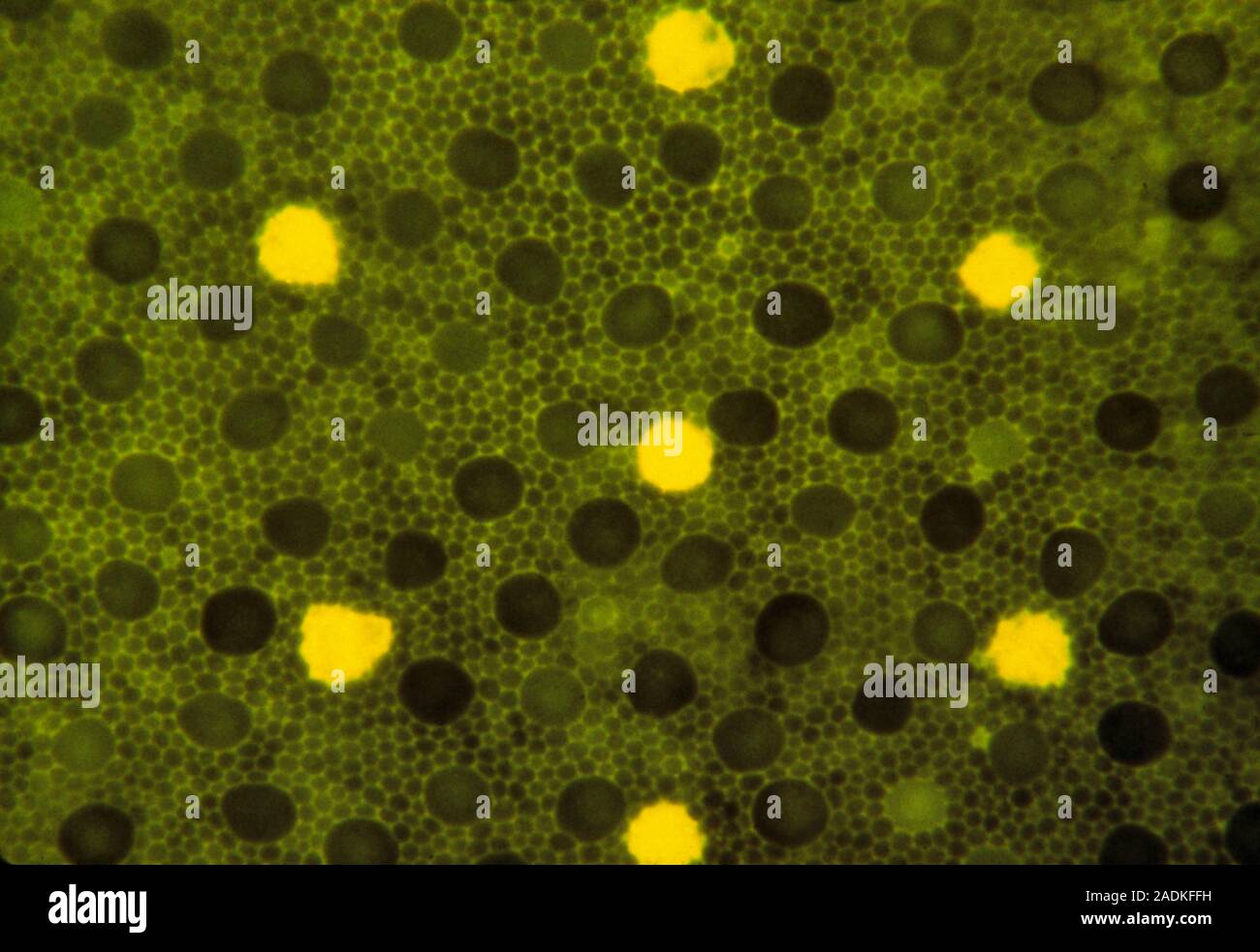 Fluorescence micrograph of a section through retina of human eye ...