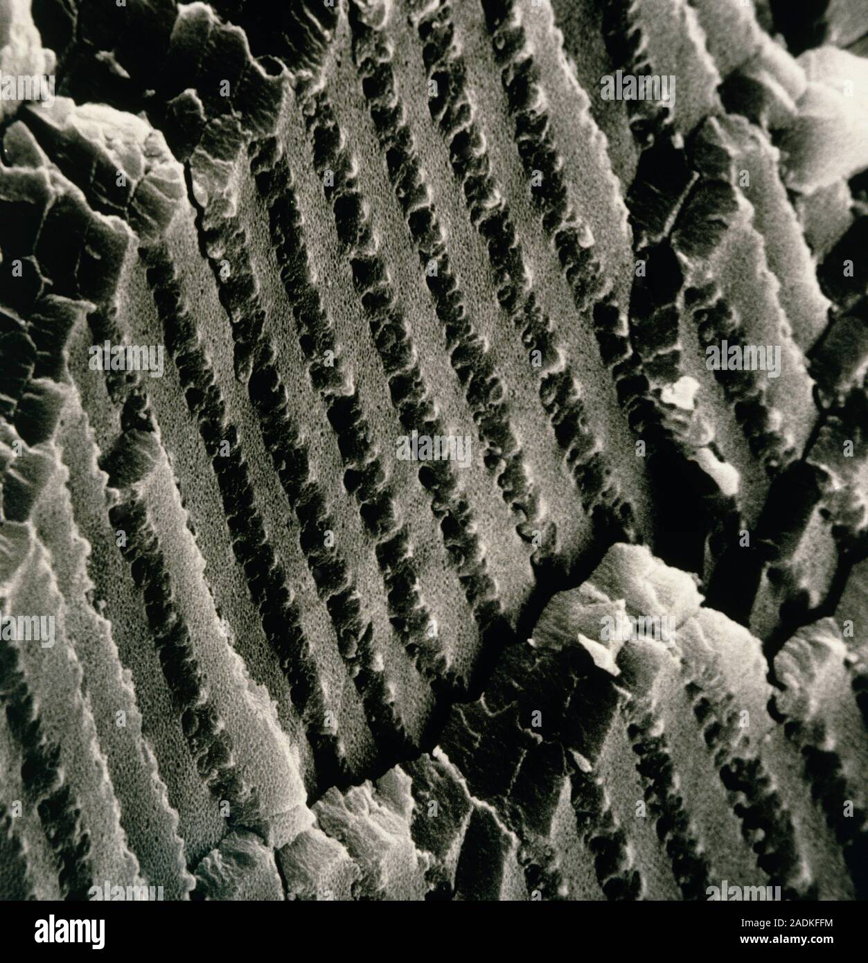 Scanning electron micrograph (SEM) of the lens of a human eye, showing ...