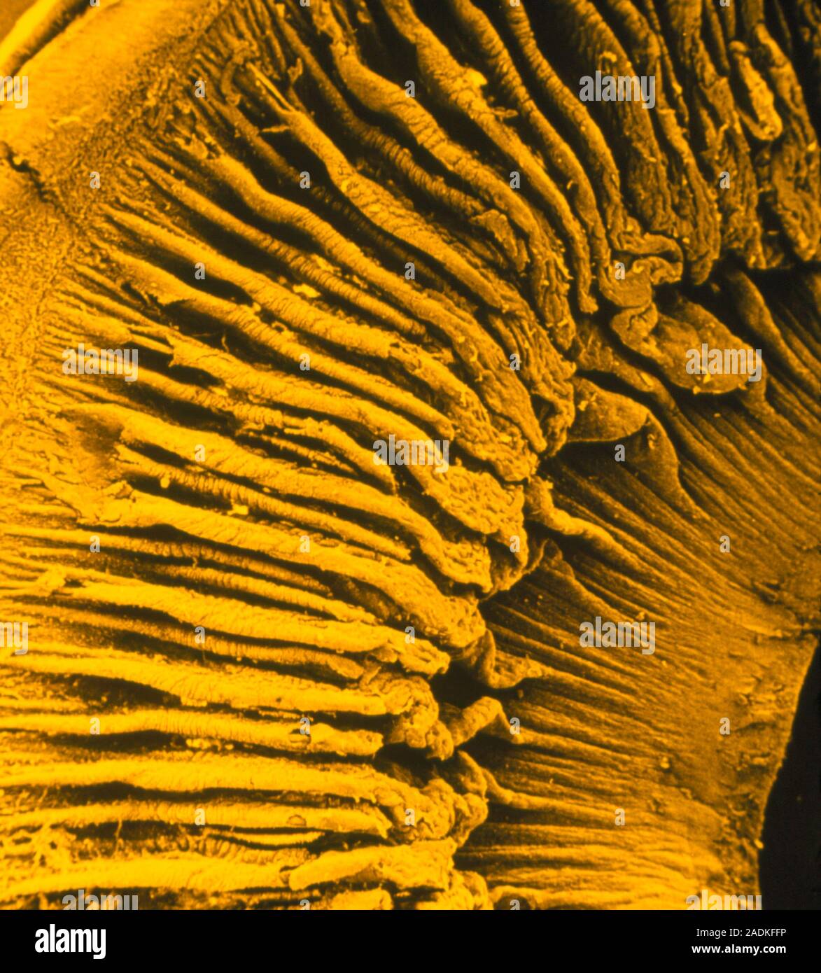 False-colour, low-power scanning electron micrograph (SEM) of the human ...