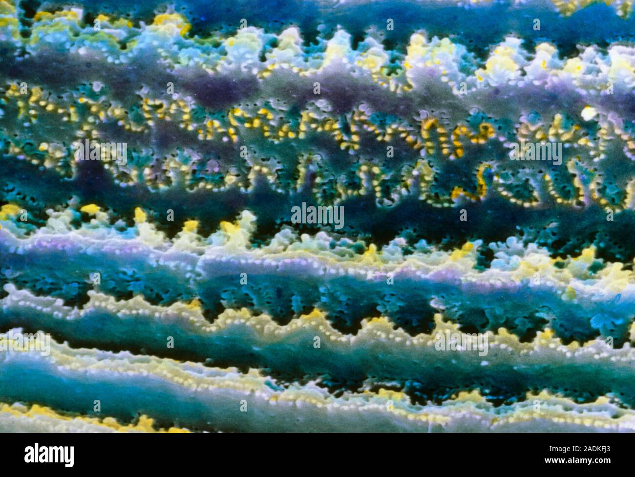 Lens of the eye. False-colour scanning electron micrograph of fibre ...