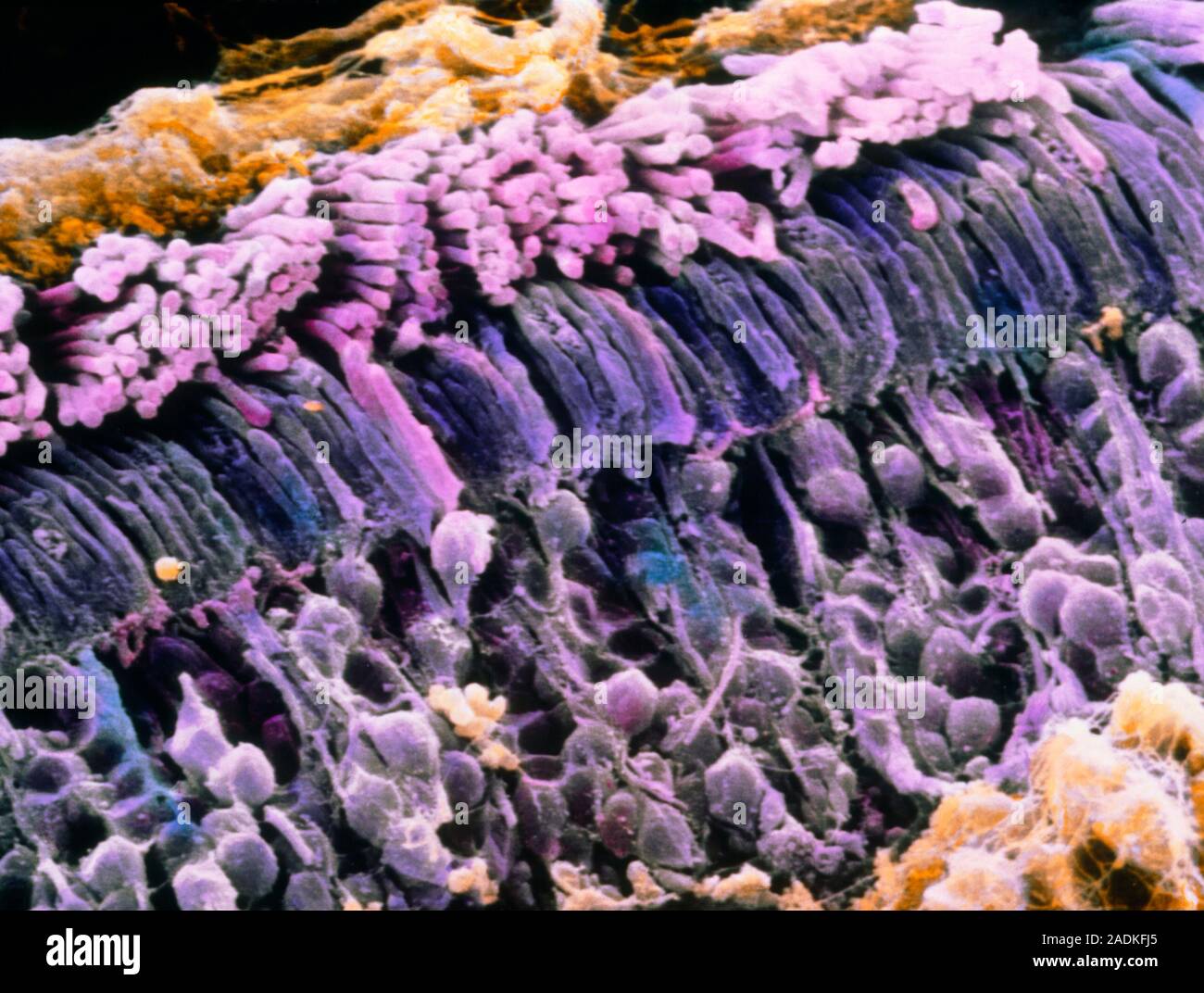 False-colour scanning electron micrograph (SEM) of rod cells situated ...