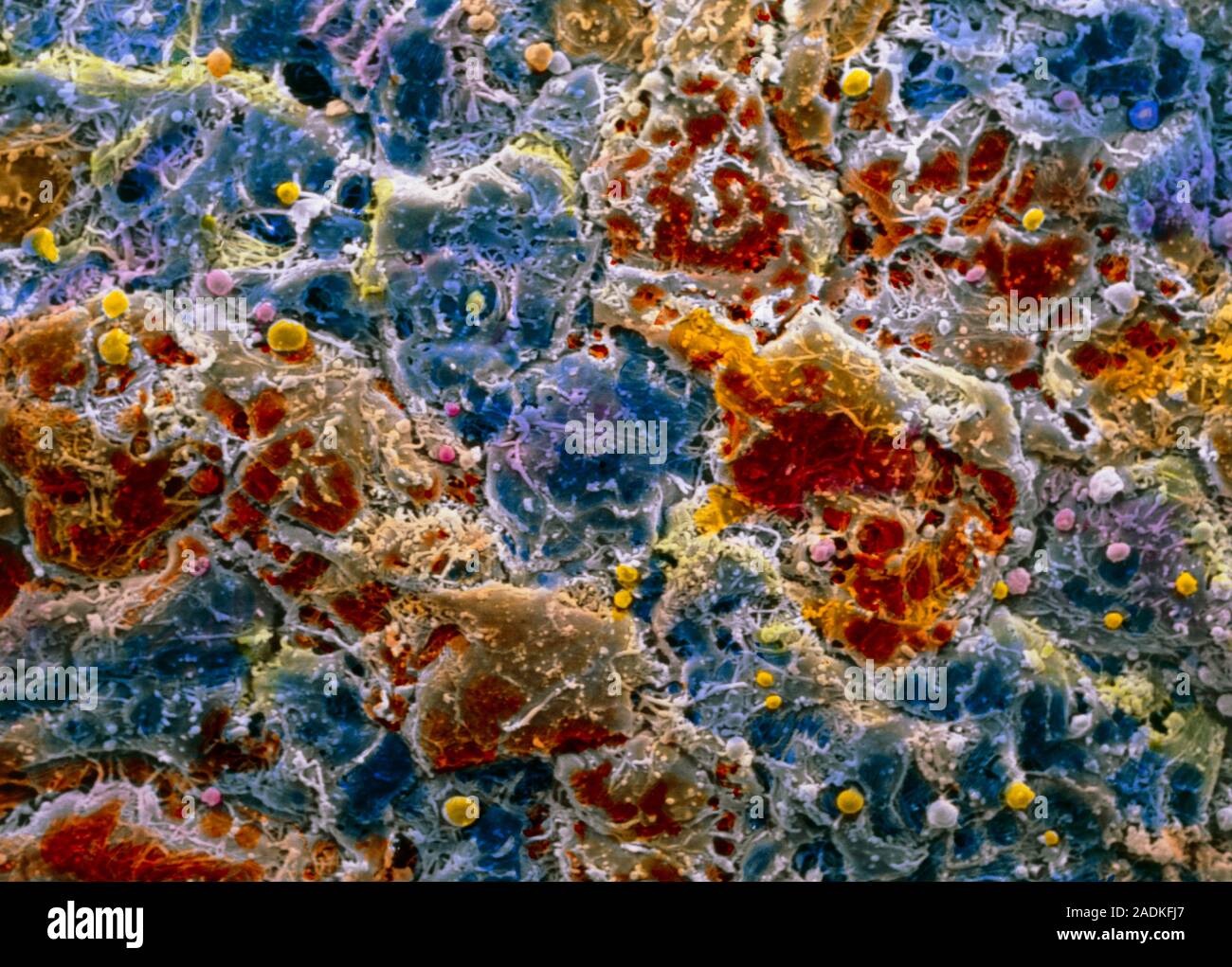False-colour scanning electron micrograph (SEM) of surface cells on the ...