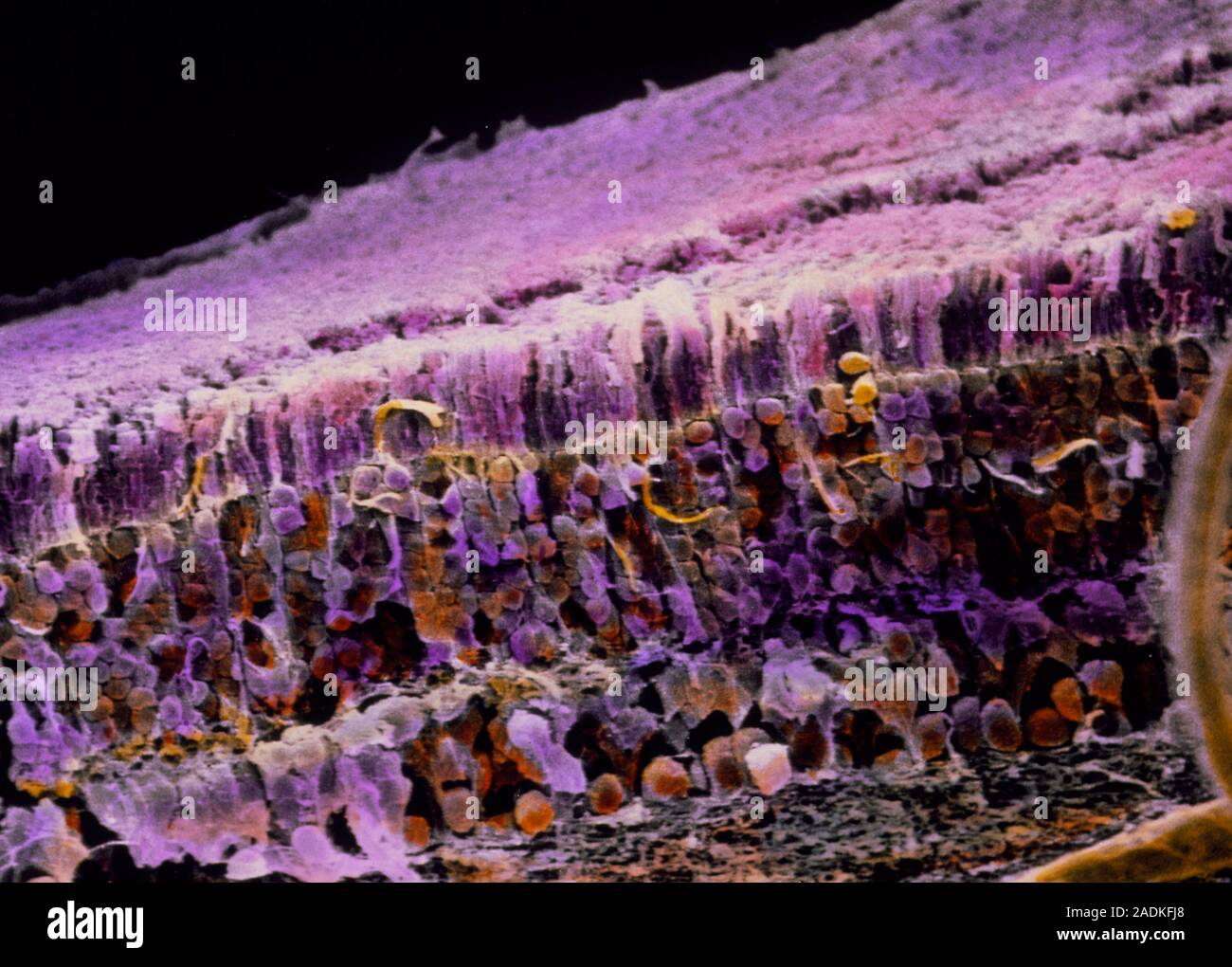 Retina. Coloured scanning electron micrograph (SEM) of the structure of ...