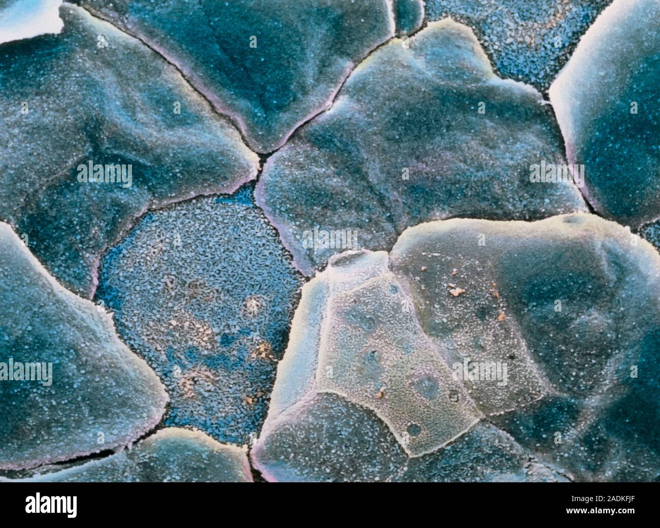 False-colour scanning electron micrograph (SEM) of the cell surface of ...