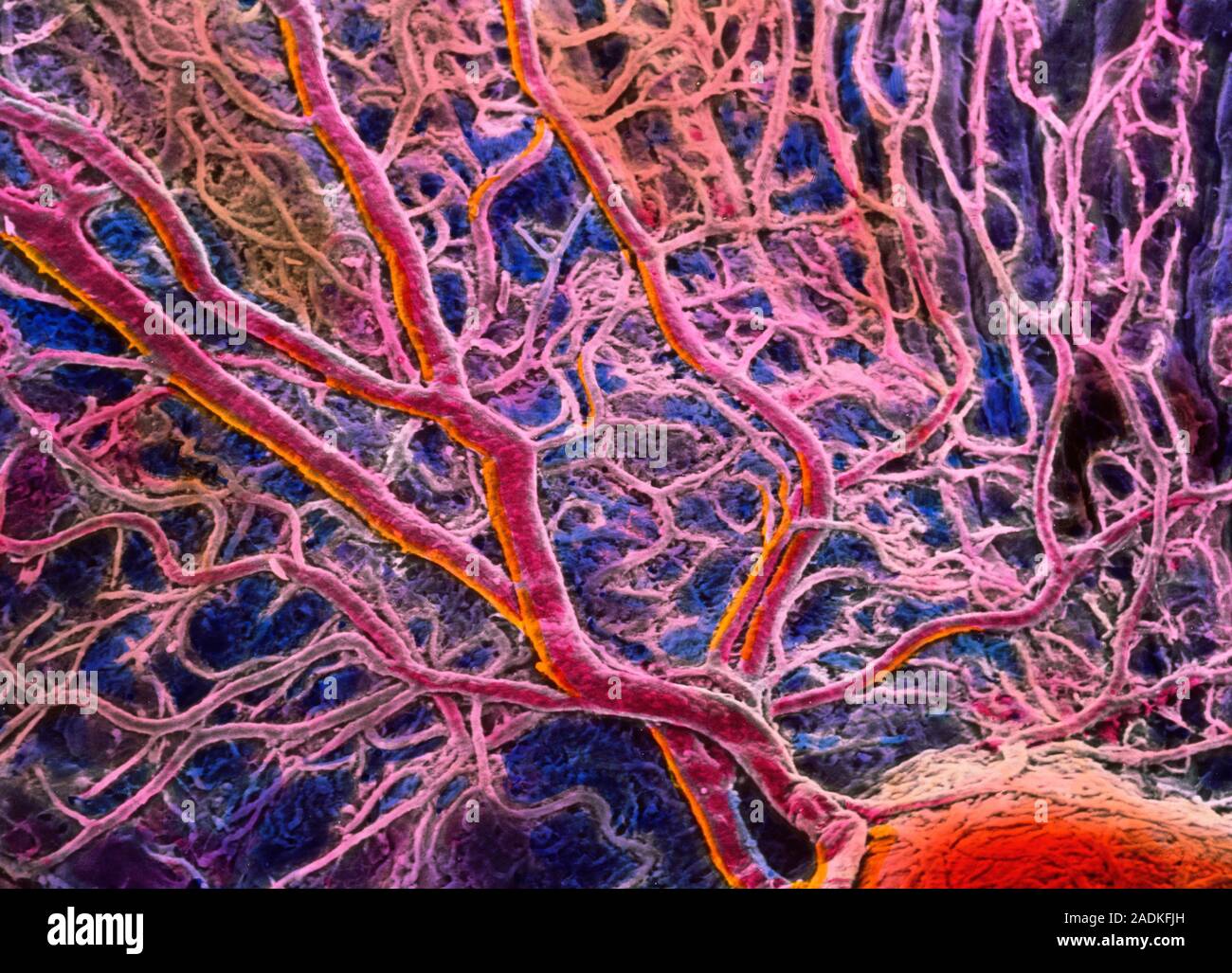 False-colour scanning electron micrograph (SEM) of blood vessels in the ...
