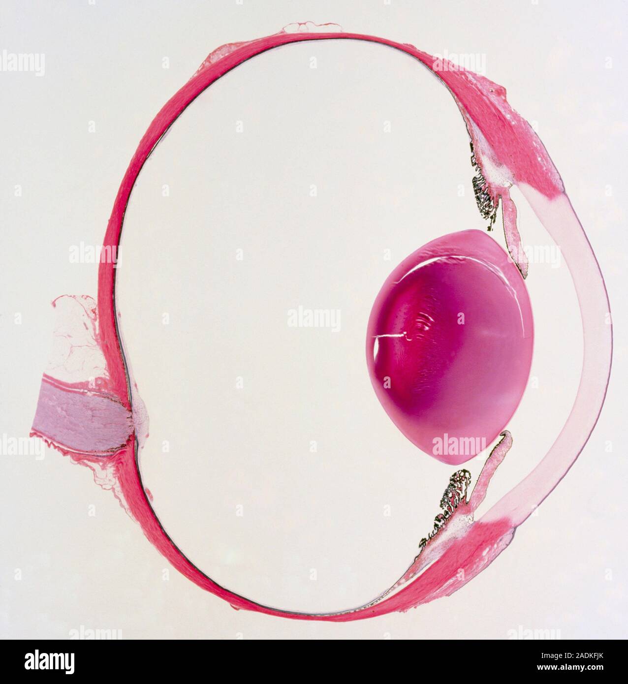 Eye. Light micrograph showing a longitudinal section of the eye. The ...