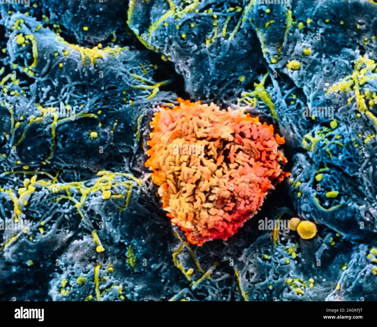 Iris cells of the eye. Coloured Scanning Electron Micrograph (SEM) of ...